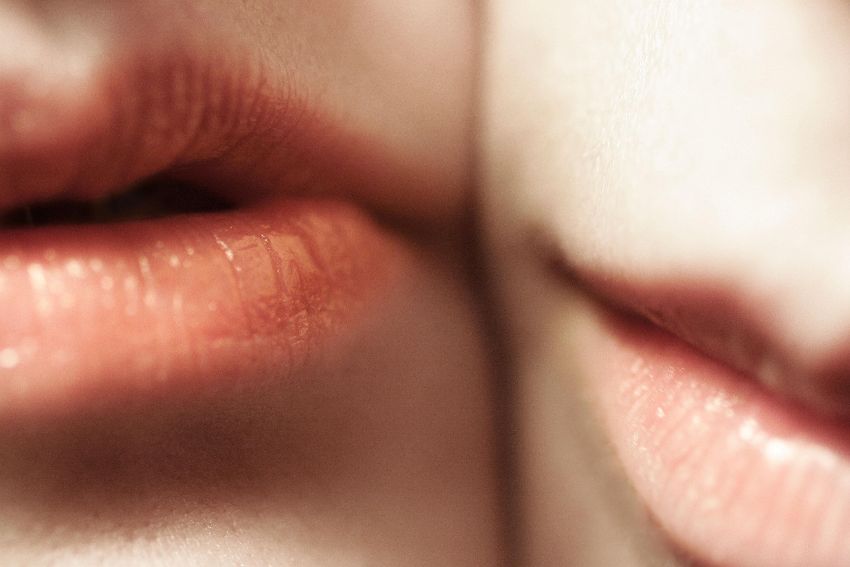How to Get Rid of Female Mustache Shadow or Upper Lip Hyperpigmentation